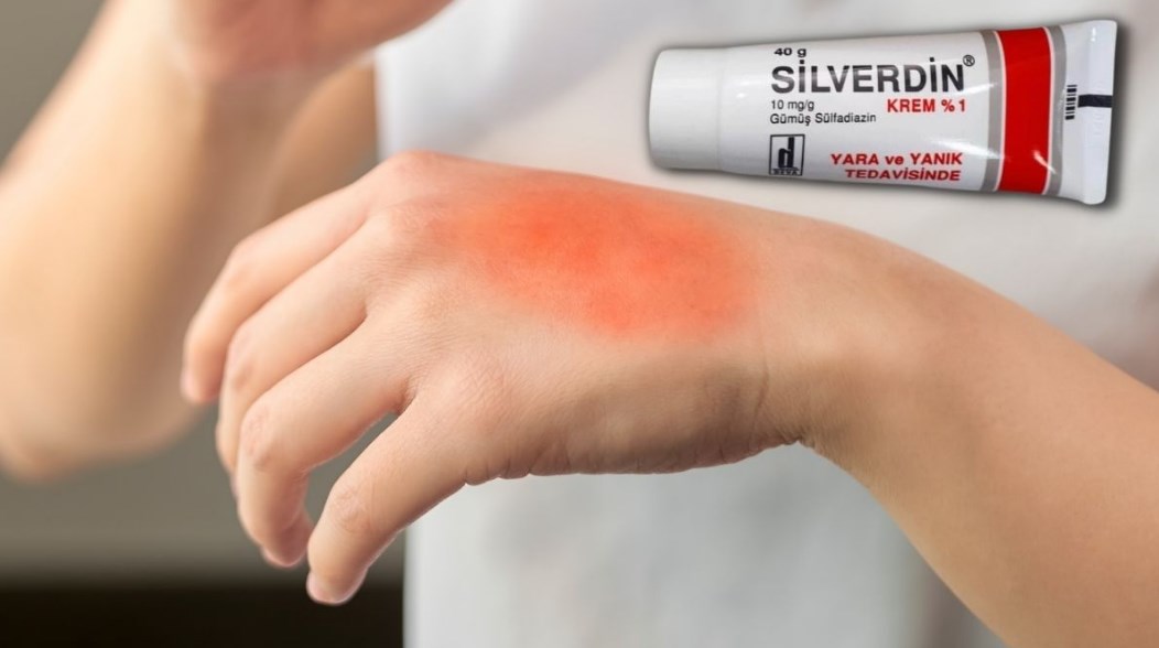 Silverdin Krem Fiyatı 2025: Reçetesiz, Plus, 40-400 GR – Fiyatı Ne Kadar